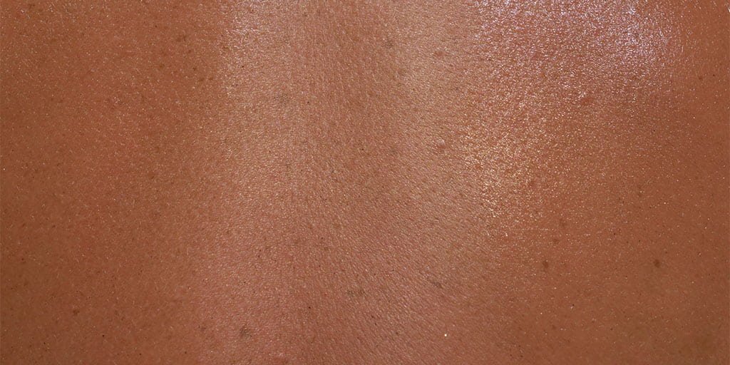 Skin Allergy: Sensitive and Reactive Skin | La Roche-Posay