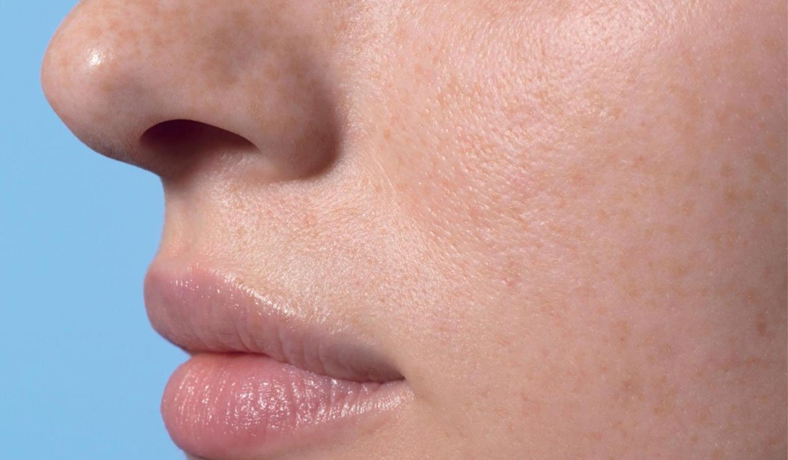 DAMAGED SKIN : causes, treatments, products by La Roche-Posay