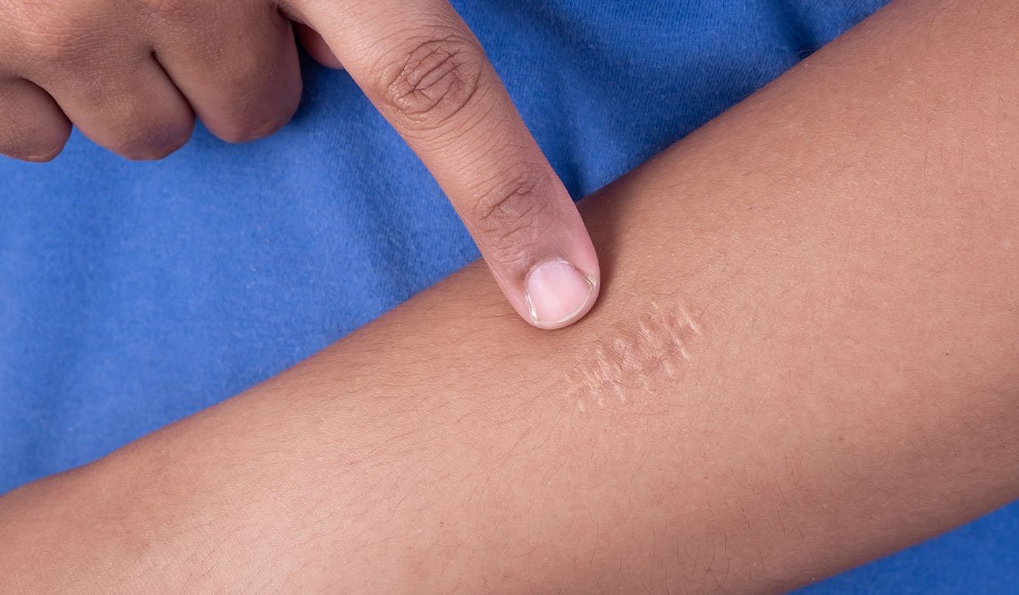 How To Repair & Reverse Skin Damage | La Roche Posay